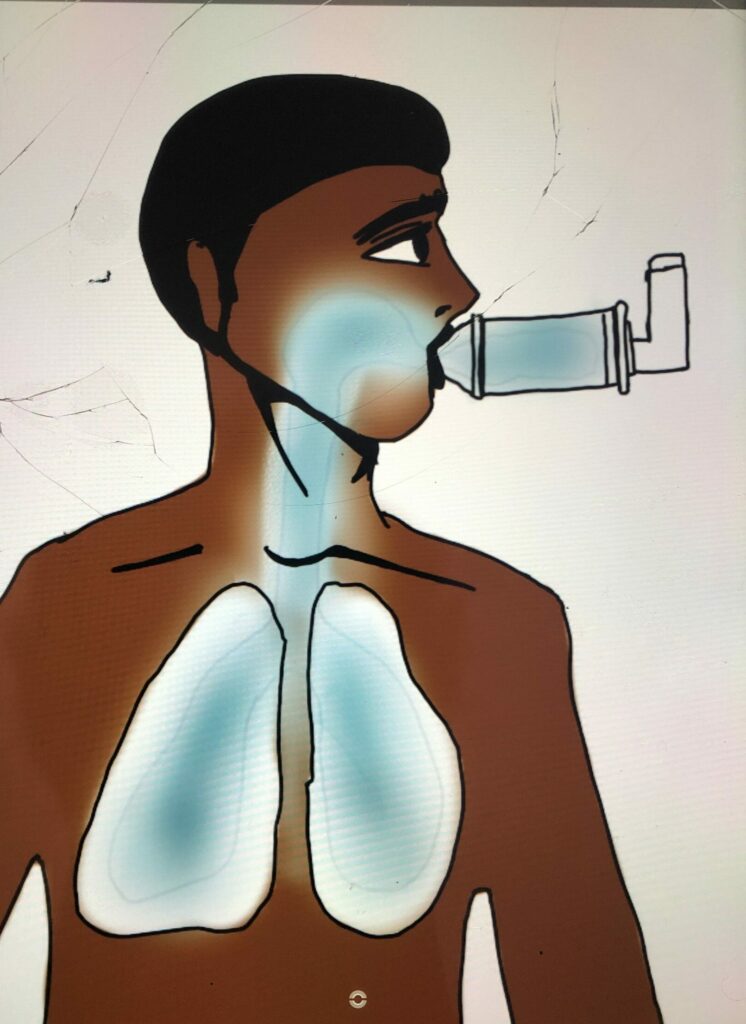 How asthma has affected me throughout my life - Transformation Partners ...